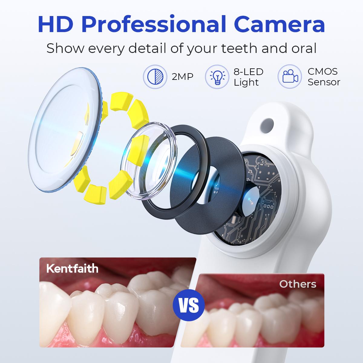 Dental Intraoral Camera WiFi 2MP Photo & Video 8 LEDs for Home ...